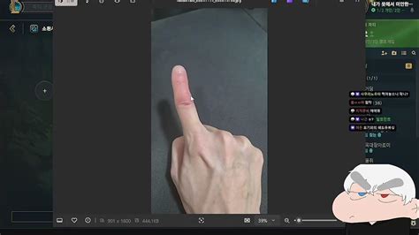 모기 물린 실프 손가락 Youtube