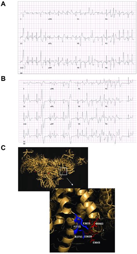Clinical Characterization Of The Catecholaminergic Polymorphic Download Scientific Diagram