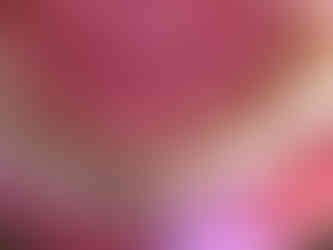 All The Different Types Of Teeth Stains 1311 Jackson Ave Dental Dentist In Long Island City NY