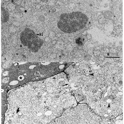Cortical Cells From Control Root Tips A The Cell Corners Lack Download Scientific Diagram