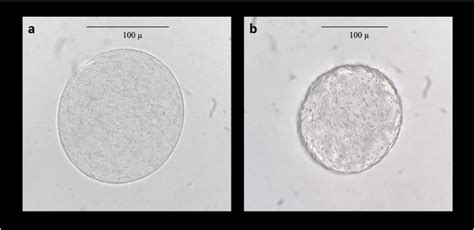 Microencapsulation And Sonication A Multiple Physical Approach To Attenuate The Probiotic