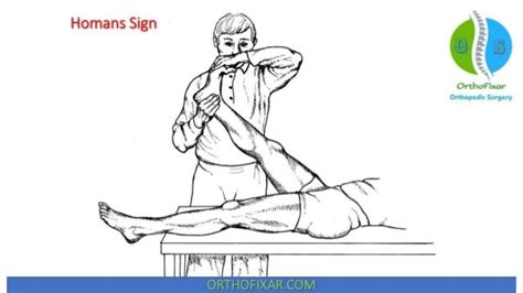 Homans Sign For Dvtpptx