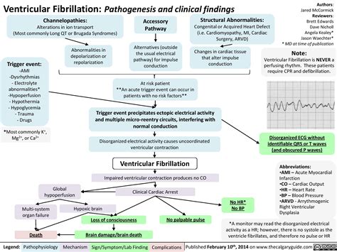 Ventricular Fibrillation Pathogenesis And Clinical Findings Calgary