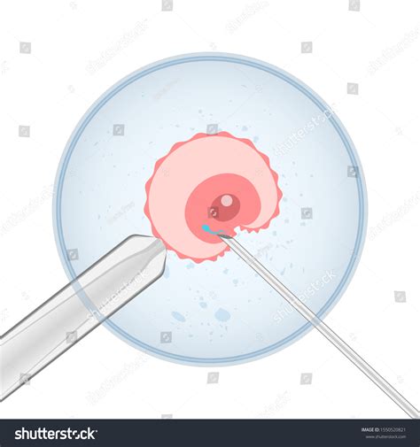 Ovum Sperm On Needle Under Microscope Stock Vector Royalty Free