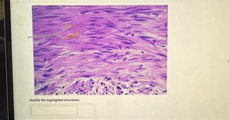 Solved Identify The Highlighted Structures Identify The