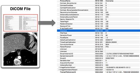 dicom metadata from an image file download scientific diagram