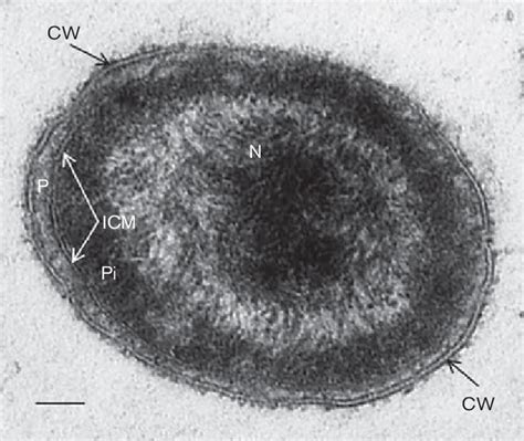 Transmission Electron Micrograph Of A Cell Of Strain Svx8 T Ultrathin Download Scientific