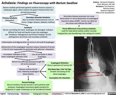 Achalasia Findings On Fluoroscopy With Barium Swallow Calgary Guide