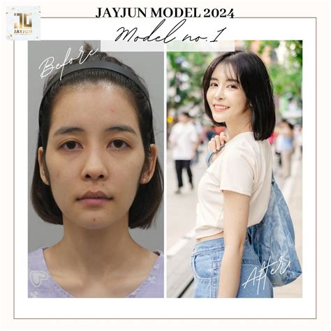 โรงพยาบาลเจจุน Jayjun Plastic Surgery Seoul