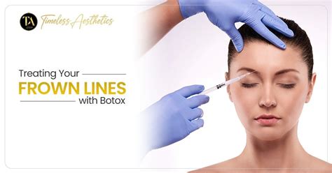 Unlocking The Power Of Botox For Frown Line Treatment U Timelessaestheticss