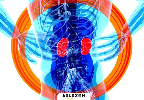 کیست کلیه چیست؟ چه افرادی مبتلا به کیست کلیوی می شوند؟ عللعلائمدرمان