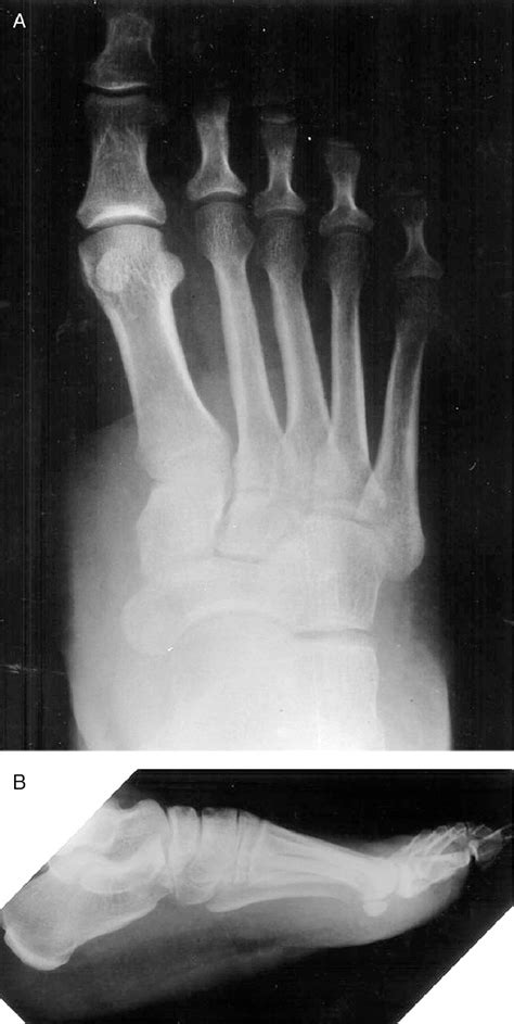 A Plain Radiographs Were Negative For Osseous Defect B An Download Scientific Diagram