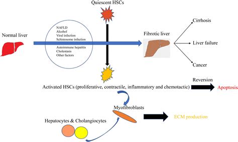 Antihepatic Fibrosis Drugs In Clinical Trials