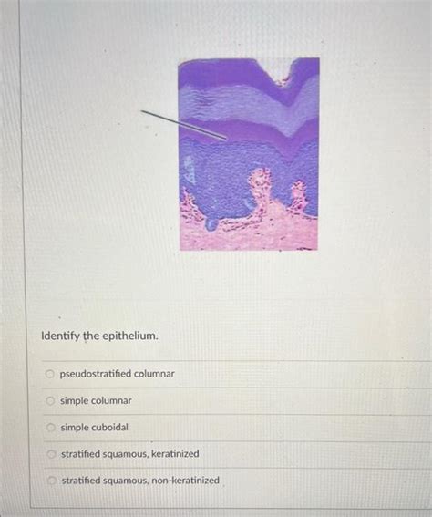 Solved Identify The Epithelium Pseudostratified Columnar