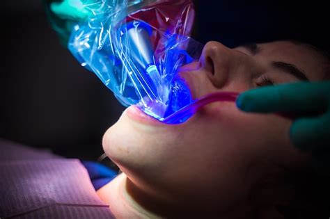 Premium Photo Close Up Of A Mouth At A Dentist Care