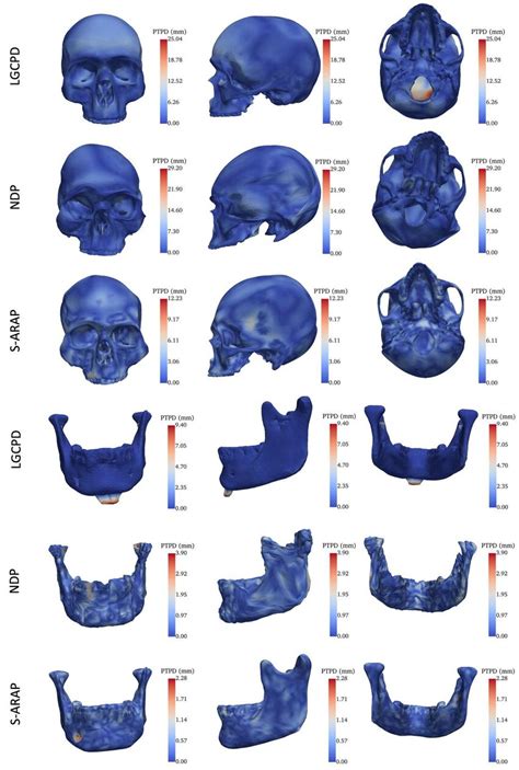 Ptpd Visualization Of Different Deformation Methods For Skull And