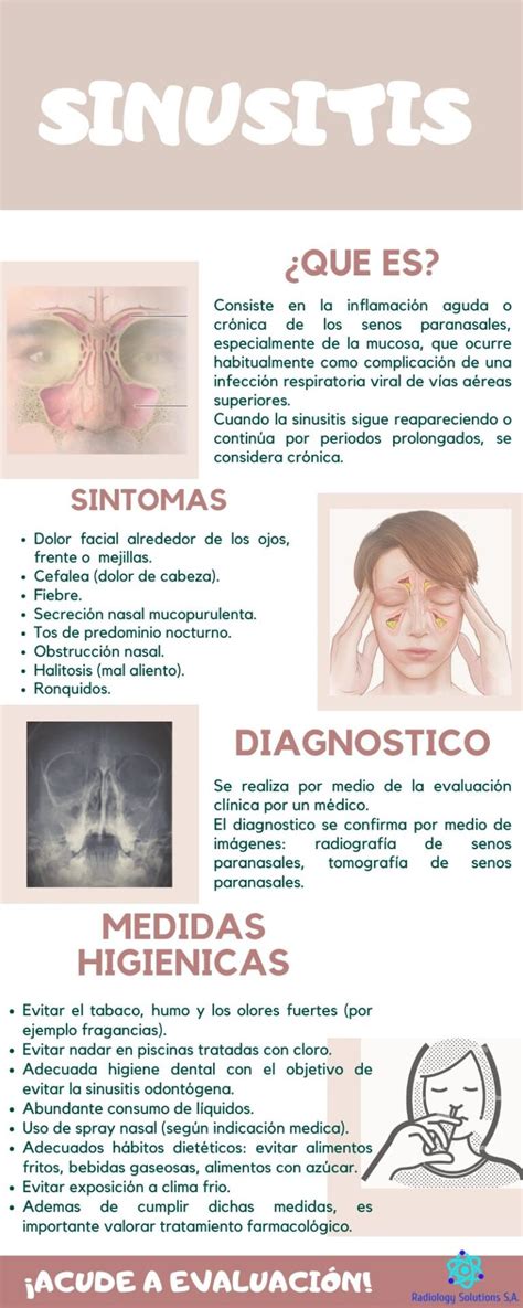 Dolor De Cabeza Puede Ser Sinusitis Vizua
