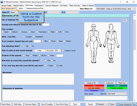 Gpm Nz Support Centre An Overview Of Custom Forms