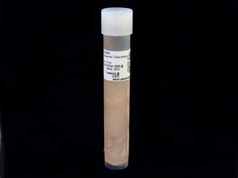 Amniotic Fluid Sample