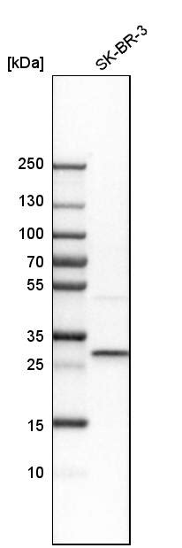 Rabbit Polyclonal Anti Ctsd Antibody Buy For Research Highly Specific Rigorously Validated