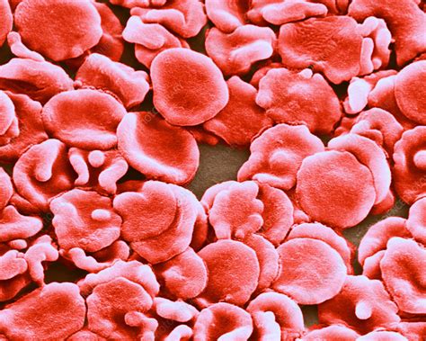 Sem Of Erythrocytes And Echinocytes Stock Image C0220430 Science