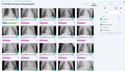 20 Open Source Computer Vision Datasets