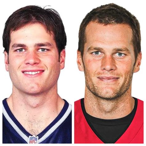 Tom Brady In 2001 Vs Tom Brady Now R Pics
