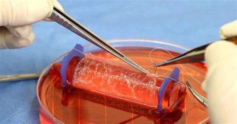 Doctors Grow Sex Organs For Patients With Rare Genetic Condition Cbs News