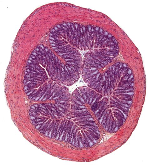 Toxoplasma Gondii Chronic Infection Decreases Visceral Nociception Through Peripheral Opioid
