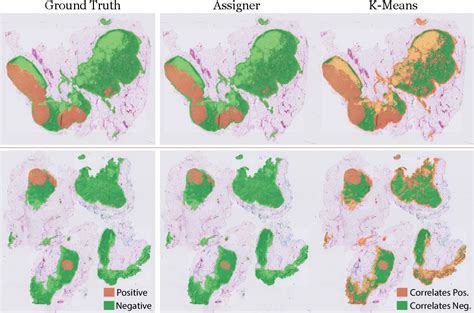 Figure 1 From Improving Representation Learning For Histopathologic Images With Cluster
