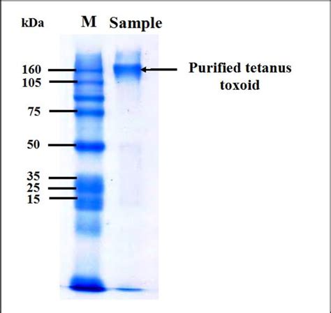 Sds Page Pattern Of Tetanus Toxoid Purified From The Alum Adjuvanted