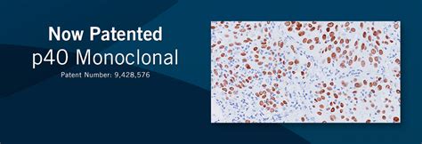 Biocare Medical Primary Antibodies Detection Instrumentation Ihc