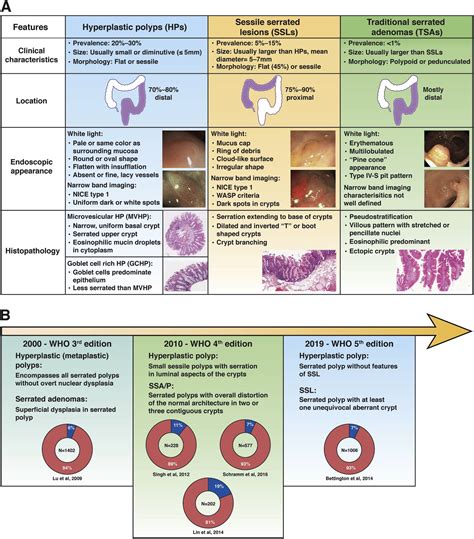Keith Siau On Twitter Classification Of Serrated Polyps 4kmeded Gitwitter