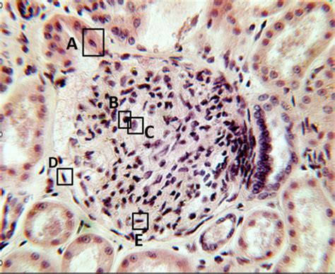 Week Renal Structures And Function Ilab Histo Images Flashcards
