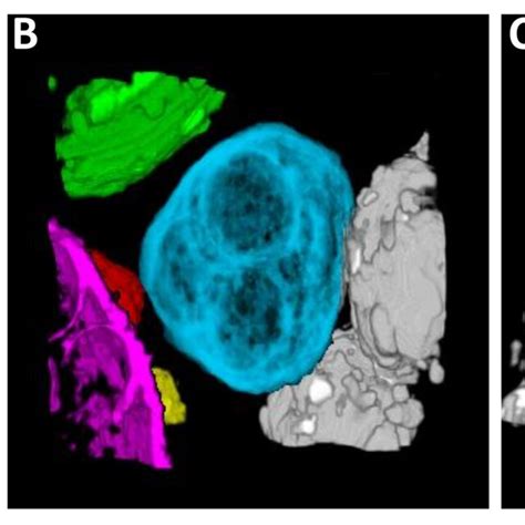 Transmission Electron Microscopy Tem Analysis And 3d Reconstruction Download Scientific