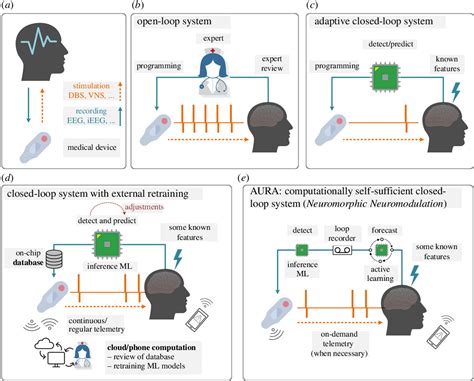 Figure 1 From Weak Self Supervised Learning For Seizure Forecasting A