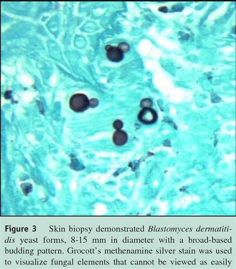 Figure 3 From A Blast From The Past Semantic Scholar