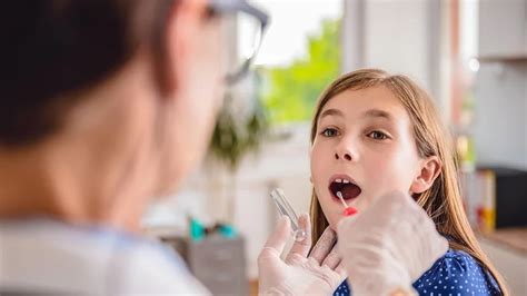 Estreptococo Cuáles Son Los Casos En Los Que Esta Enfermedad Se Vuelve