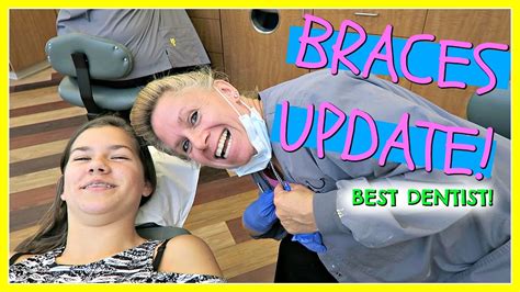 Braces Update Vlog Youtube