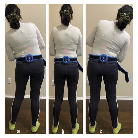 Pdf Effect Of Task Specific Training On Trunk Control And Balance In Patients With Subacute Stroke