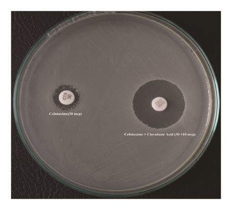 Positive Combination Disk Test For The Phenotypic Detection Of Esbl Download Scientific Diagram