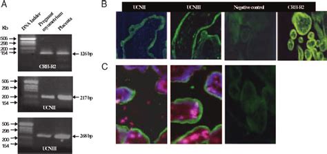 A Crh R2 Ucn Ii And Ucn Iii Mrna Expression Analysis In Human Term