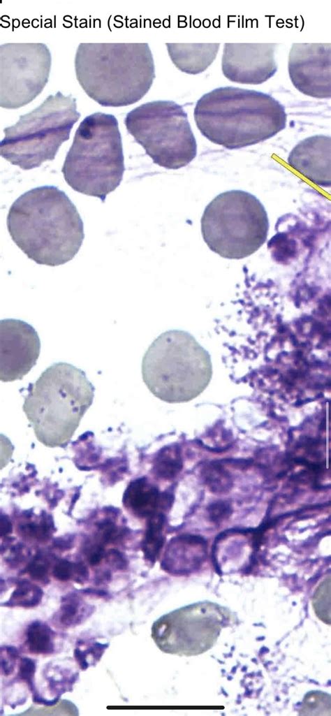 Bacteriaparasite Identification Rmicrobiology