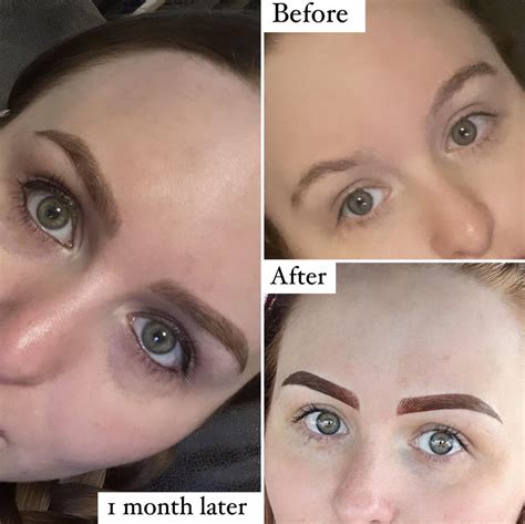 Are Big Chunks Of Flaking During Healing Normal Rmicroblading