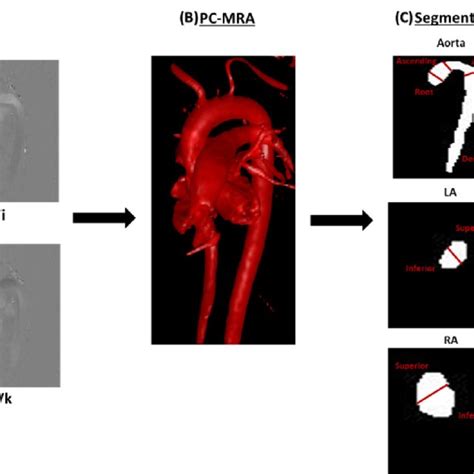 Postprocessing Of 4d Flow Data First 4d Flow Velocity Data In Each