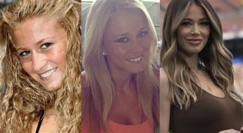 Diletta Leotta Come è Cambiata Dopo La Chirurgia «mi Dicono Sei Di Plastica Ma Che Cè Di Male