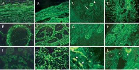 Figure 3 From Latent Transforming Growth Factor β Binding Protein 1 Interacts With Fibrillin And