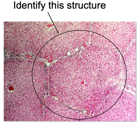 Bio 380l Liver Gallbladder And Exocrine Pancreas Slides Flashcards