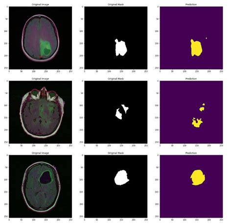Github Promithal Brain Mri Image Segmentation