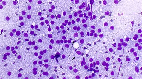 Mct Archives Eclinpath